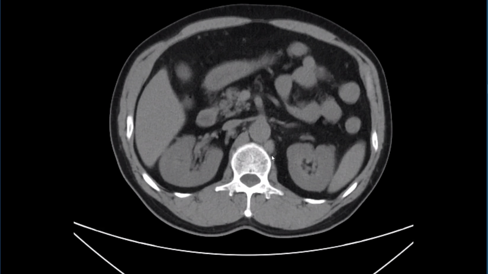 全身CT诊断与报告书写讲解学习班_哔哩哔哩_bilibili