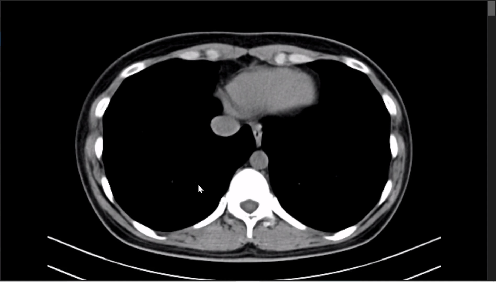 全身CT诊断与报告书写讲解学习班_哔哩哔哩_bilibili
